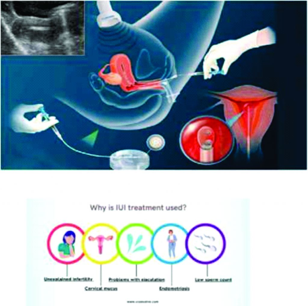 Infertility Services and In-Vitro Fertilization - Dr. Balwant Singh's ...